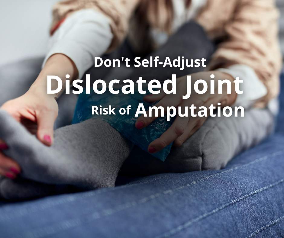 Don't Self-Adjust a Dislocated Joint — Risk of Amputation! - หมอโป้ง ...